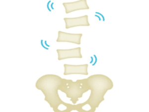 What is Lumbar Instability? | International Lumbago Clinic
