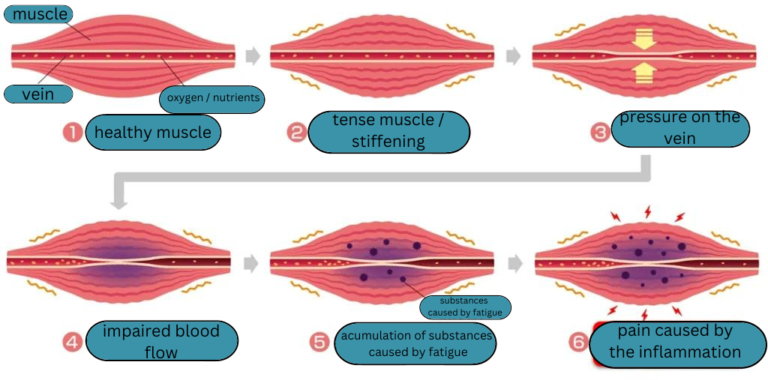 The Relationship Between Muscles and Blood | International Lumbago Clinic