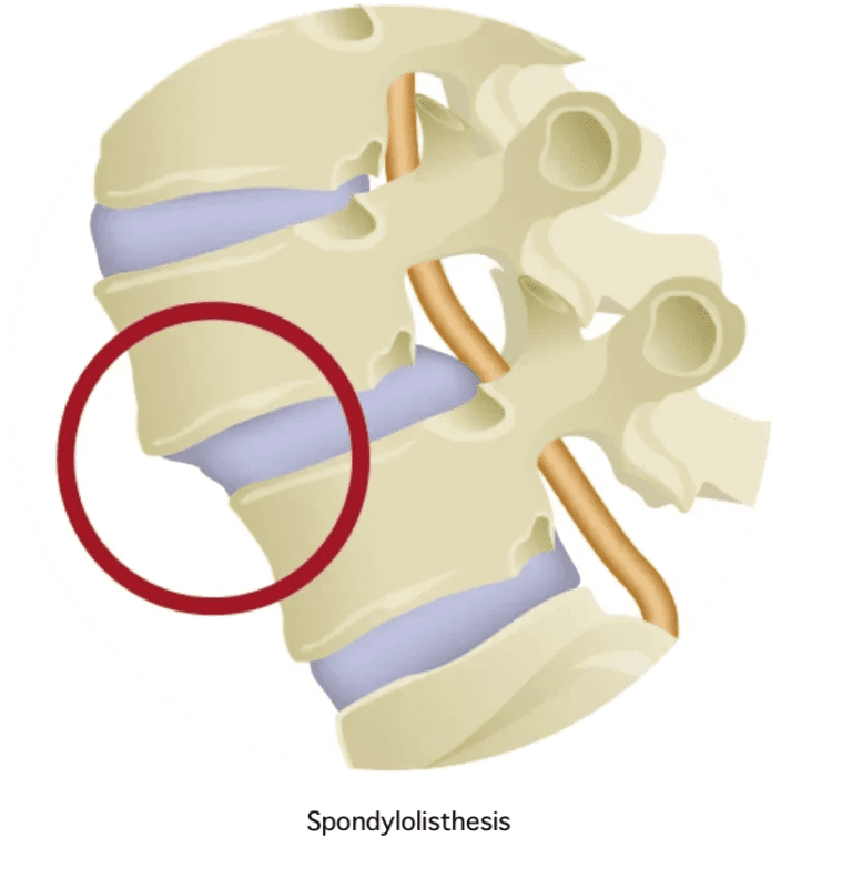 Block Injections Don't Work! Why Block Injections Are Not Effective For ...