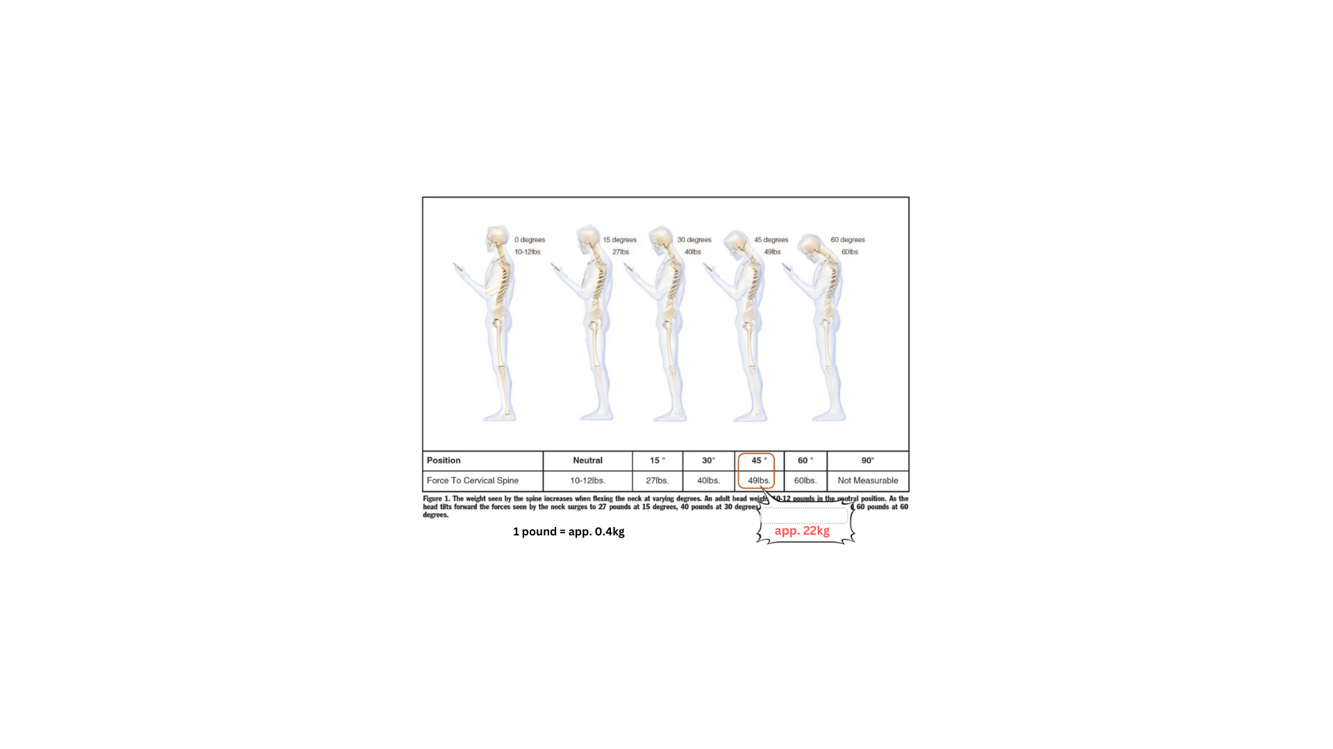 How to Choose a Hospital For Disc Herniation: What Key Points Should ...