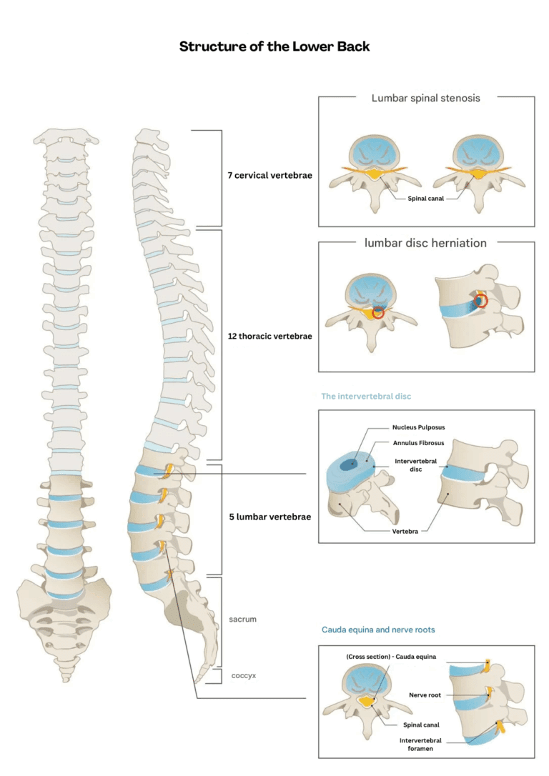 What is Spinal Canal Stenosis? Symptoms, Causes, and Treatments ...